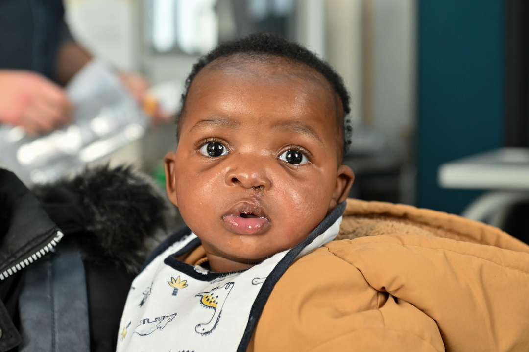 Smile Week: ACSA Supports Life-Changing Initiative At Frere Hospital In ...