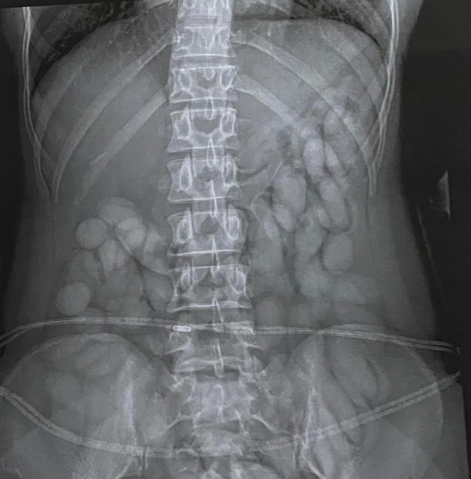 Namibian Drug Mule Arrested At OR Tambo Airport Has Expelled At Least ...