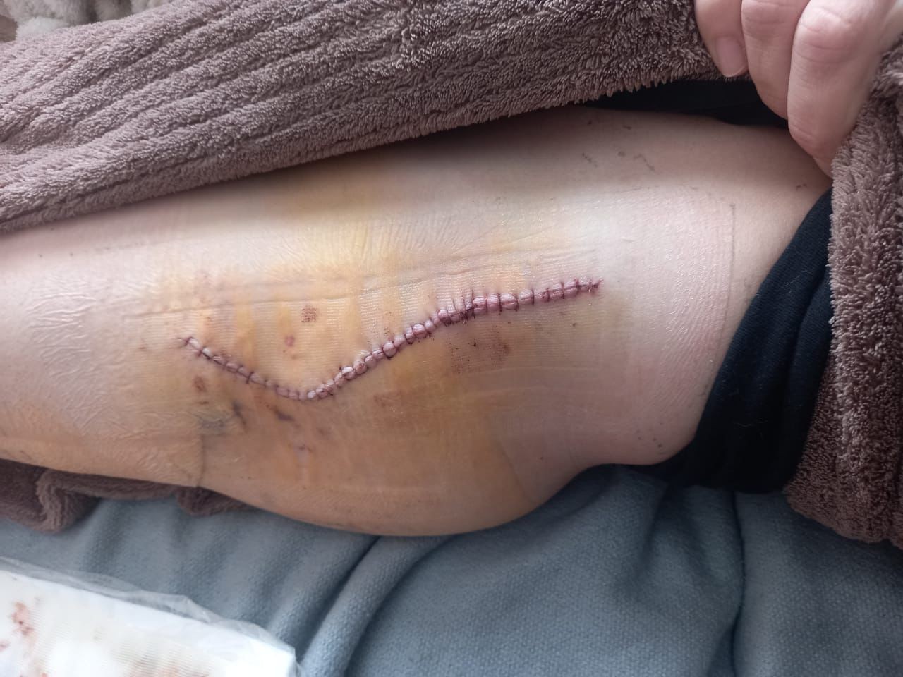 Acting Judge To Face Attempted Murder Charge Following Bloody Road Rage ...